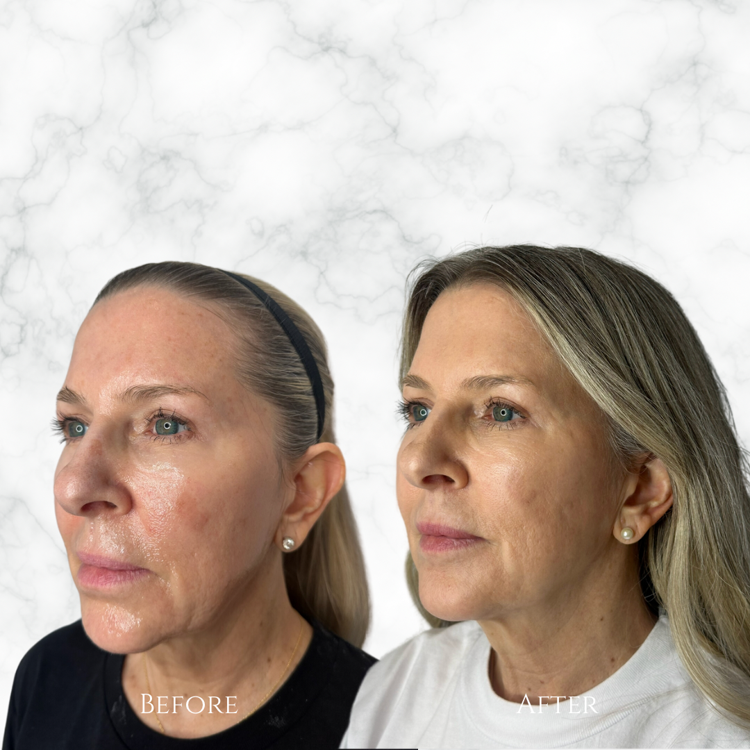 Attiva Skin Rejuvenation West Palm Beach & Near Me